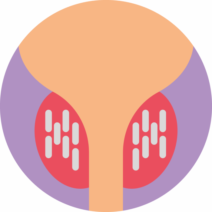 Low Dose Rate Brachytherapy - Prostate Cancer Research